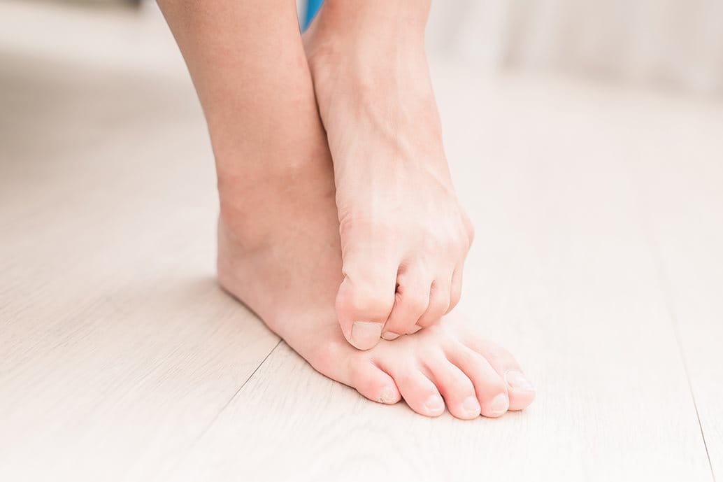 Prurito ai piedi: cause e i rimedi | Eucerin Prurito ai piedi: cause e i rimedi | Eucerin